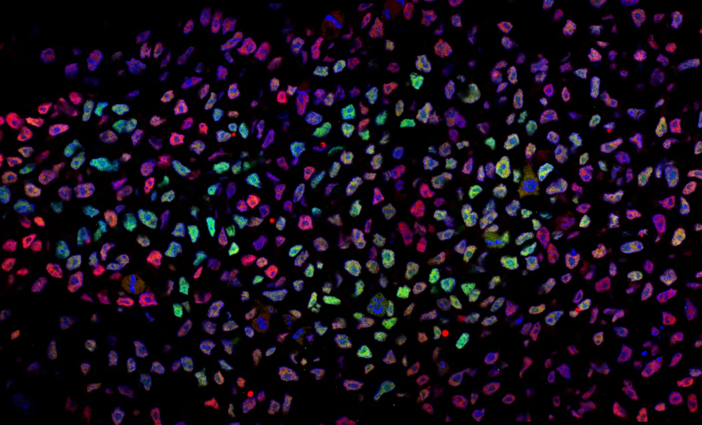 Hypermorph (en) - CBI